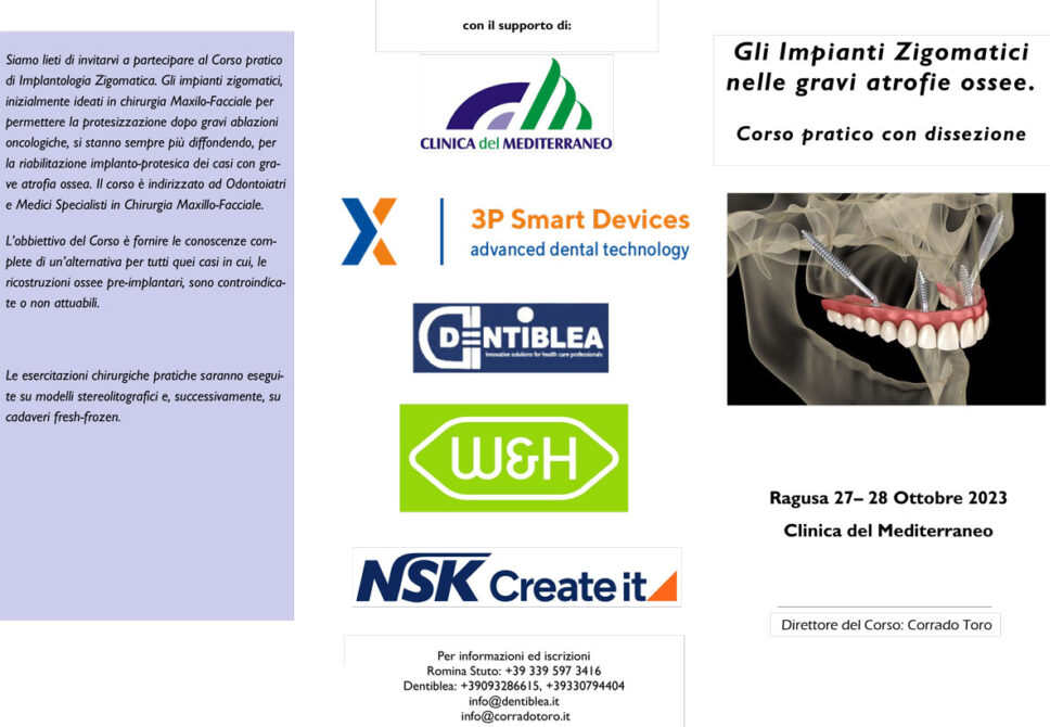 Gli Impianti Zigomatici nelle gravi atrofie ossee. - 3P Smart Devices